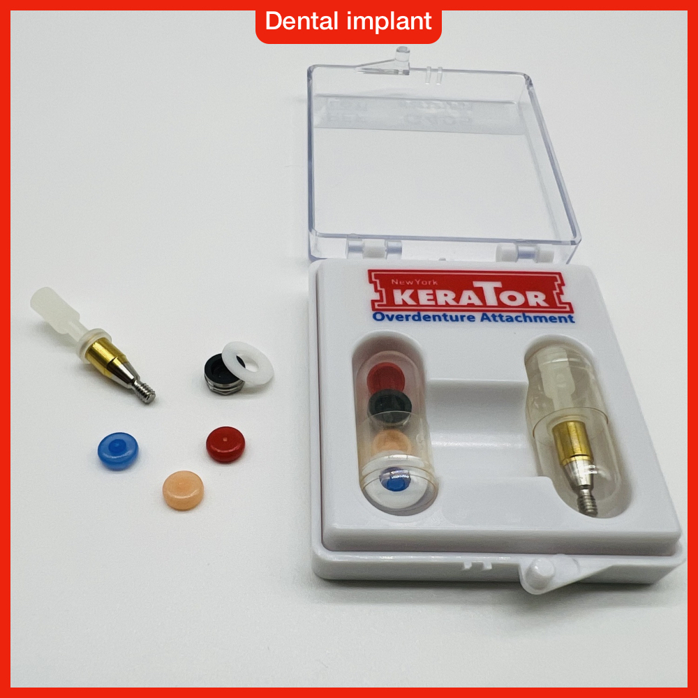 osstem植體的價格推薦 - 2025年3月 | 比價比個夠BigGo